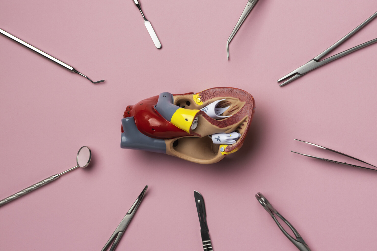 Understanding Corrosion in a Bioabsorbable Vascular Implant