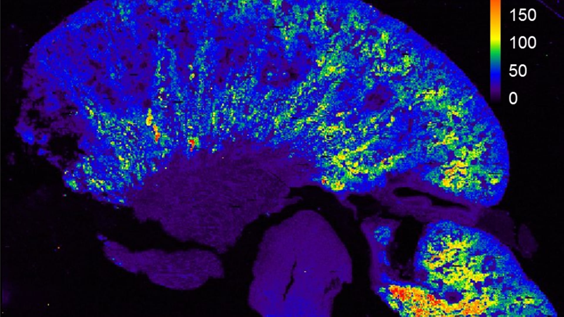 High-Resolution Elemental Imaging of Biological Tissue